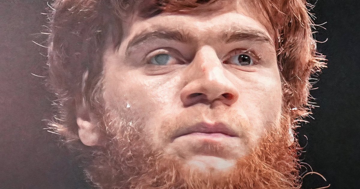 Diskuze: Má jen jedno oko, proto 'Shara | nastartu.cz